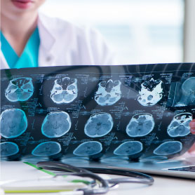 Brain MRI Scan Near Me in Gurgaon, Upto 70% Off in Brain MRI Scan Cost ...